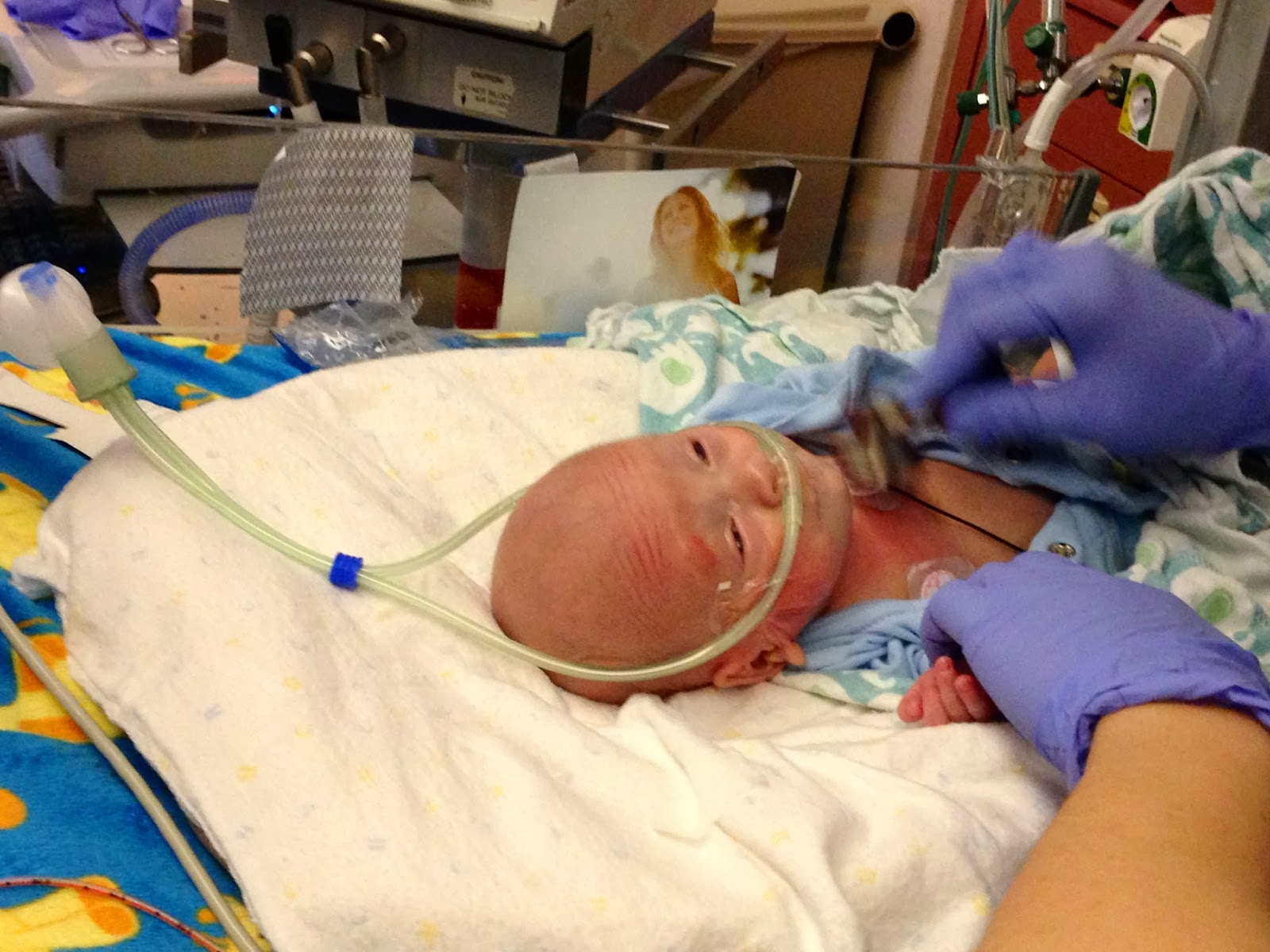 Blessings for Benton: Extubation Station and then a Derailment: Days 98-107