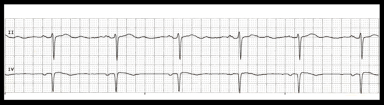 Practice EKG Strips 329