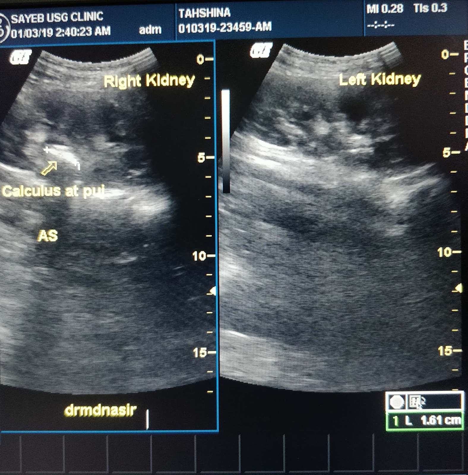Human Ultrasonography - Health and Nutrition