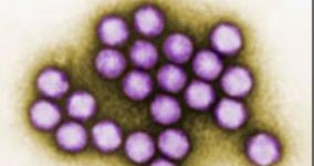 Avian Flu Diary: EID Journal: Human Adenovirus Associated with Severe ...