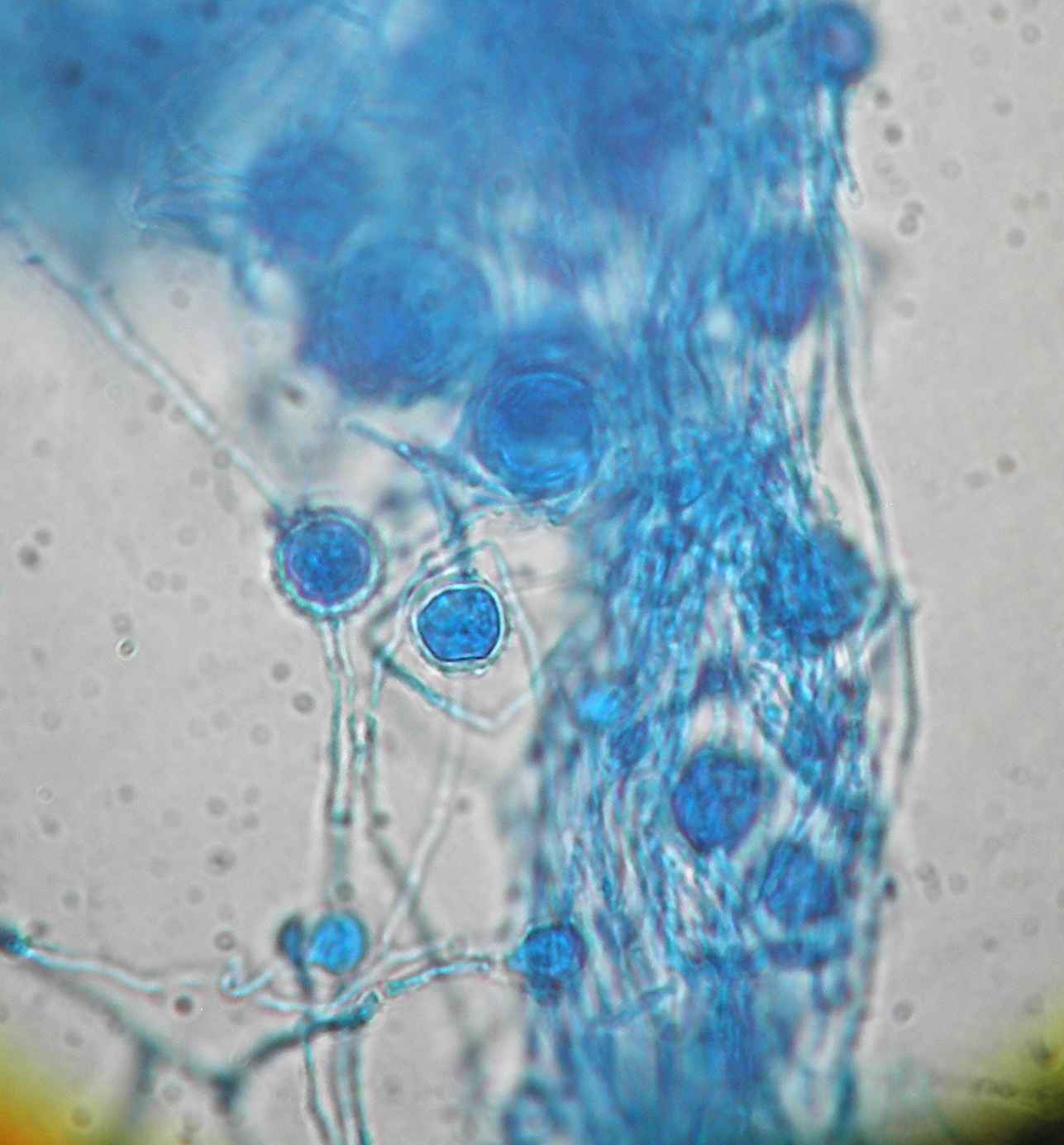 ATLAS MICOLOGIA: HISTOPLASMA DUBOISII