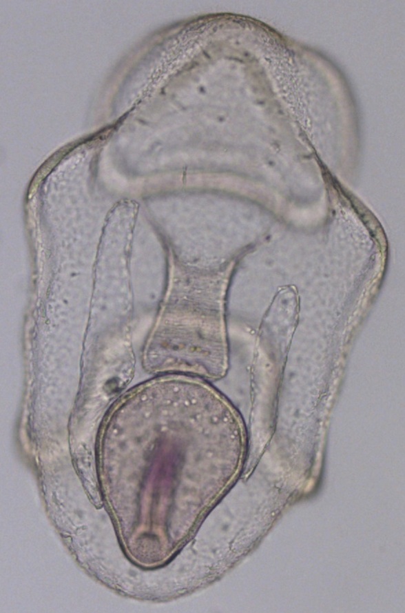 Invertebrate Embryology: Coelom formation in bipinnaria