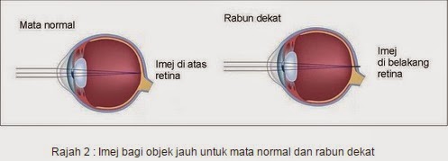 Lagenda Optometrist: PERBEZAAN RABUN DEKAT DAN RABUN TUA