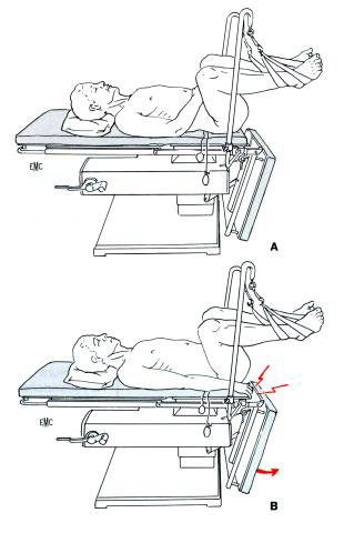 Taysir assistance الإسعاف الطبي تيسير: Position gynécologique