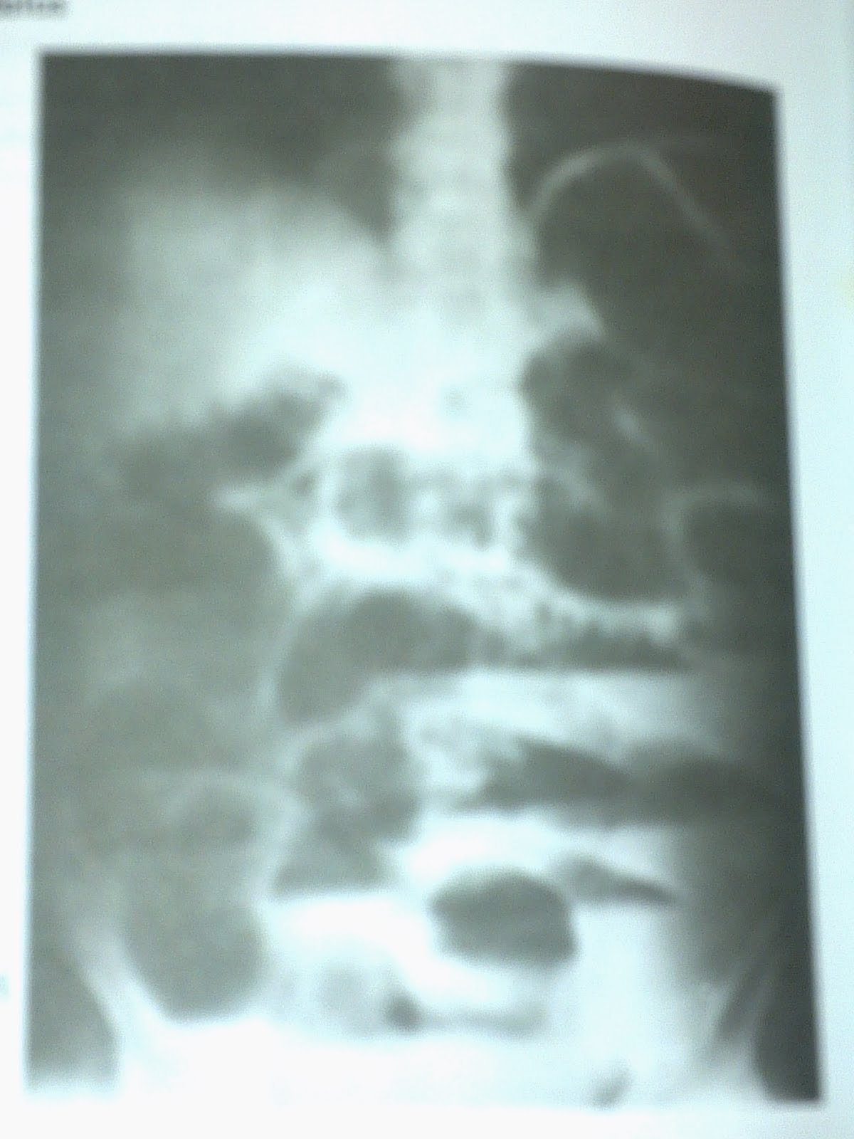 ChyntiaBlog: Radiologi Abdomen dan Urogenital