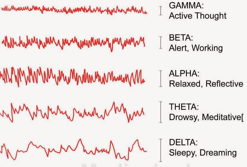 Brainwave Entrainment: Impact of Brainwave Audio Program