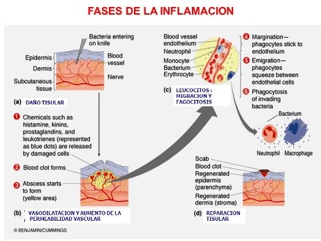 Inflamación.