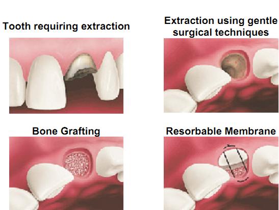 Dentistry lectures for MFDS/MJDF/NBDE/ORE: Advantages of Dental ...
