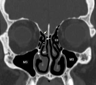 ENT for medical students: NOSE - Examination