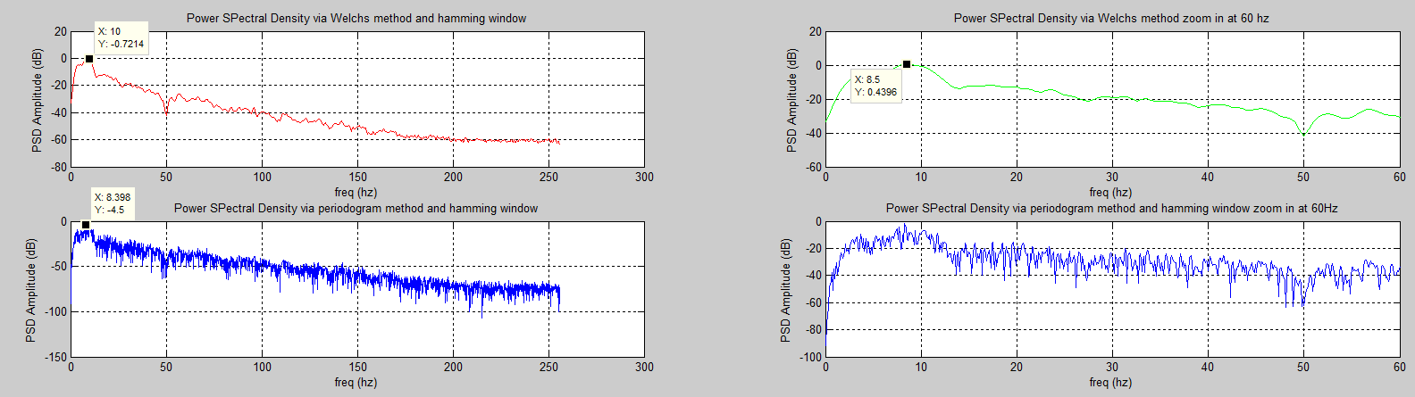 Biomedical Signal And Image Processing Projects Using Matlab And