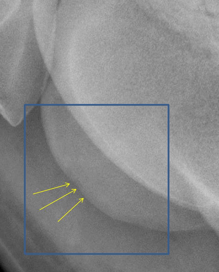 Michael Porter, Equine Veterinarian: Stifle OCD!!
