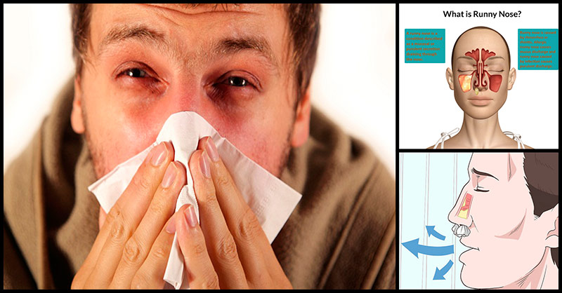 Use These Natural Remedies To Stop A Runny Nose | Dr Farrah MD