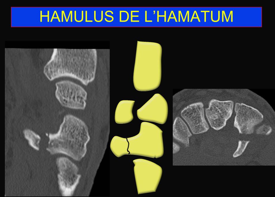Un médecin du sport vous informe