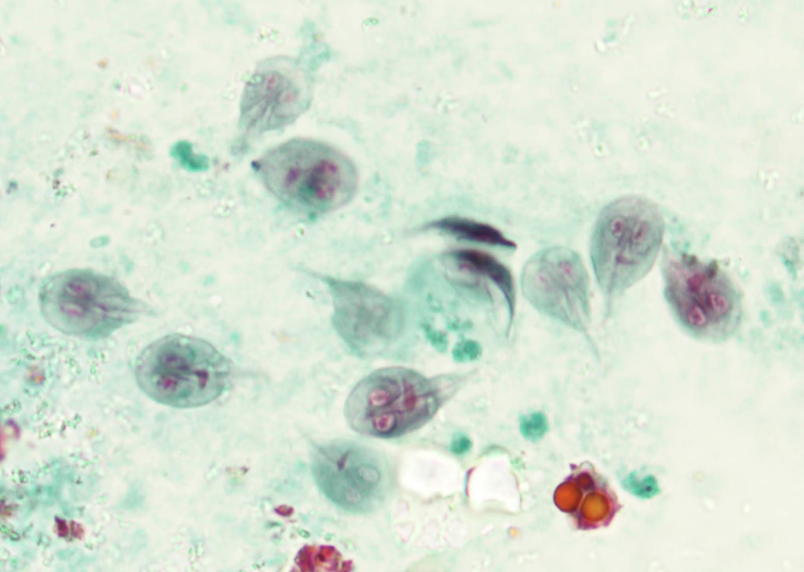 Giardia Cyst In Fecal Float