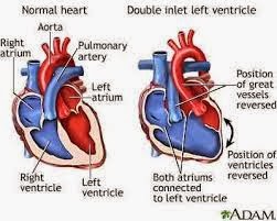 Dunlap Family Journey: What is DILV?