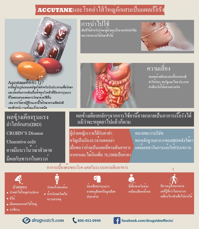 หากเราใช้Accutane หรือ isotretinoin เพื่อรักษาสิวจะเป็นอย่างไรบ้างมาดูกัีน
