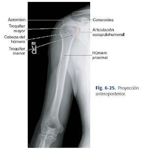 PRODUCCION Y TRATAMIENTO DE IMAGENES DIAGNOSTICAS: CAPITULO HUMERO Y ...