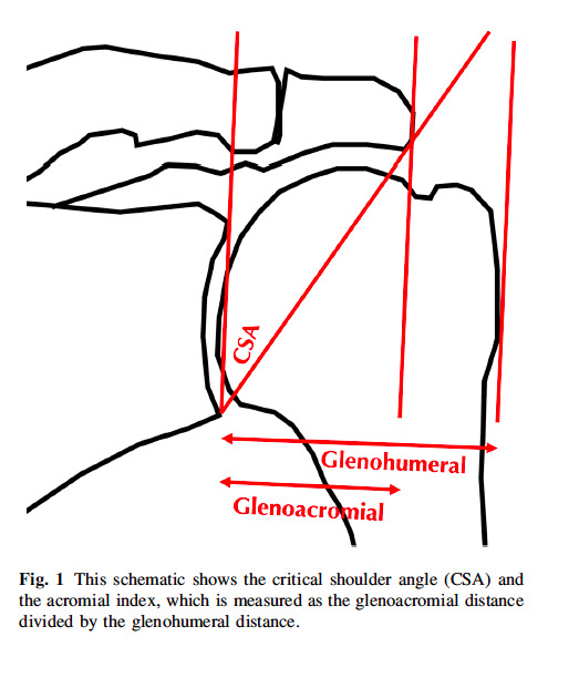 Shoulder Arthritis / Rotator Cuff Tears: causes of shoulder pain: Is ...