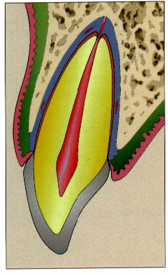 Dental Care: Classification of Dental Trauma
