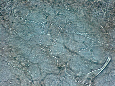 Fun With Microbiology (What's Buggin' You?): Trichophyton rubrum