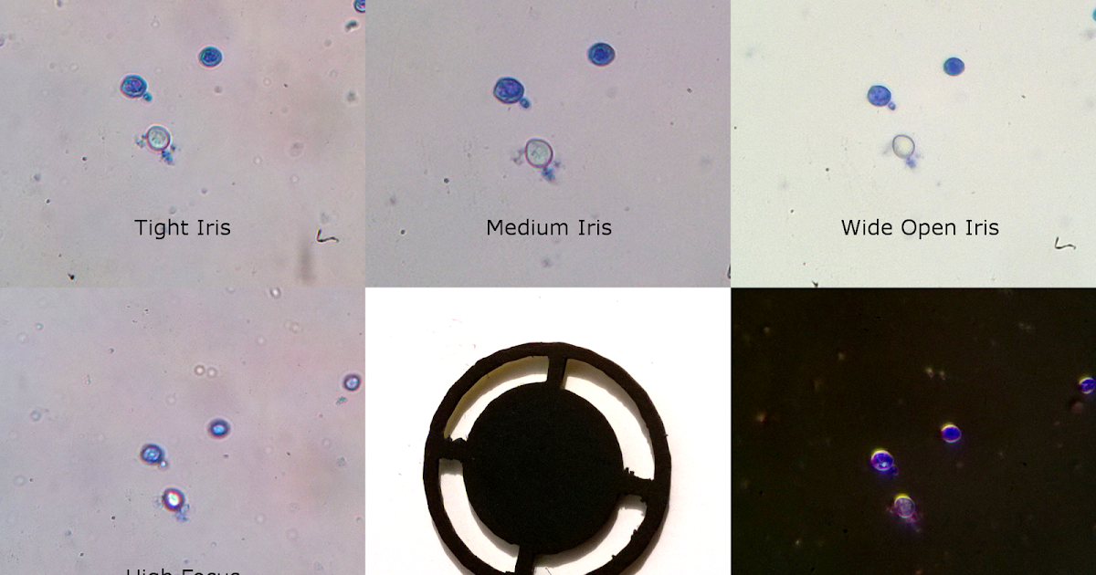 Woodland Brewing Research Automated Cell Counting Of Yeast Using Imagej