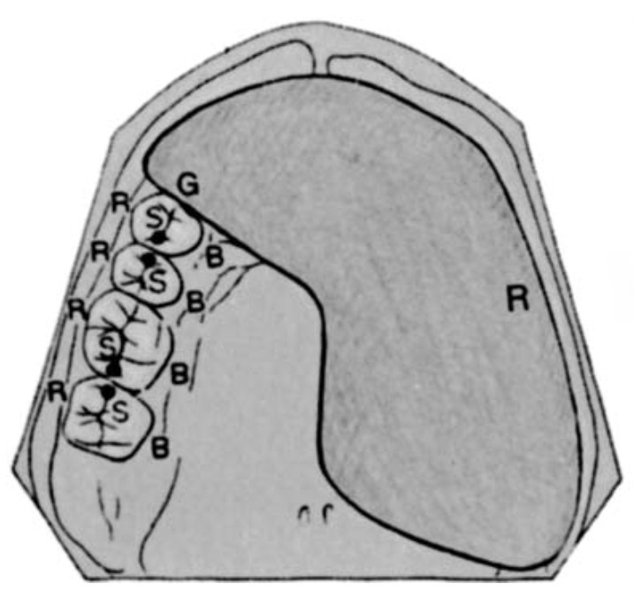 PMF Víctor Orduña: CLASIFICACIÓN DE DEFECTOS MAXILARES POSTQUIRÚRGICOS ...