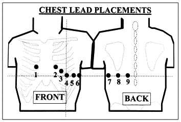 ER goldbook: ECG technique