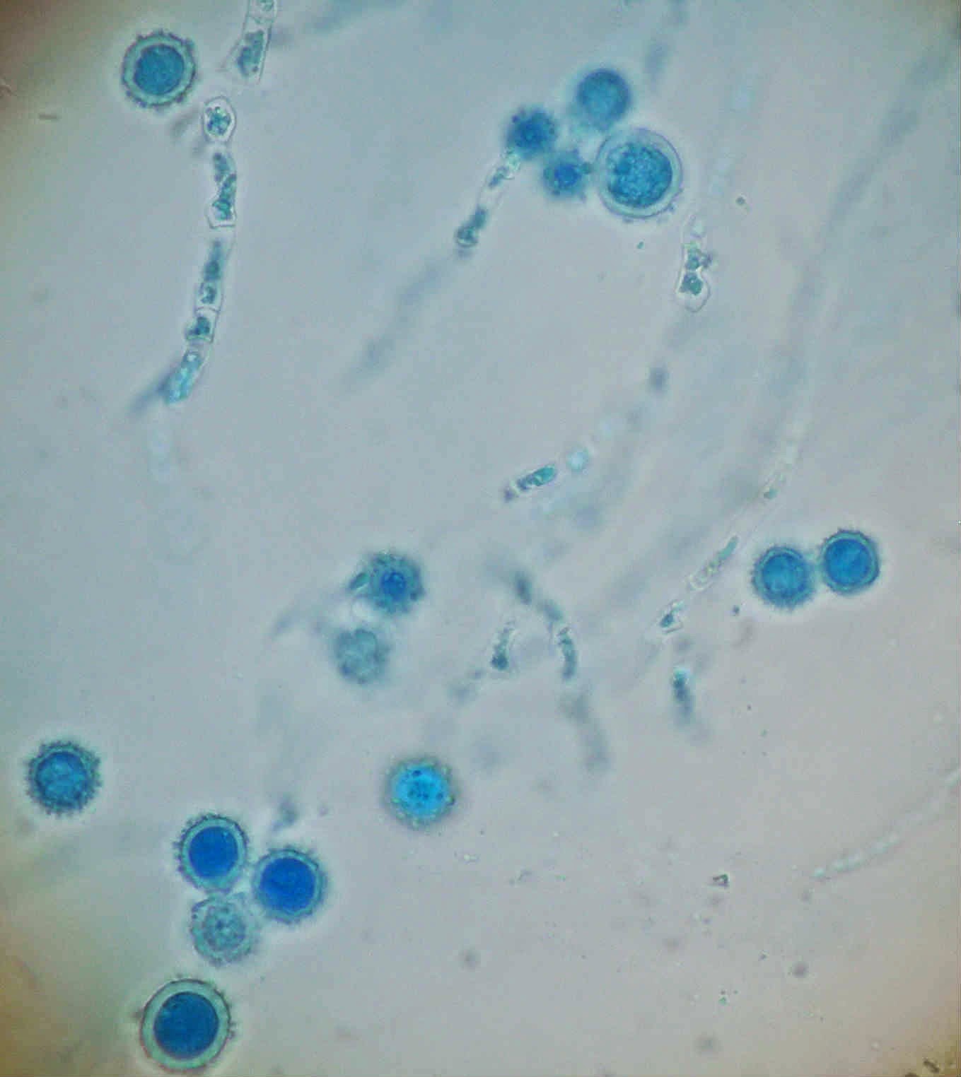 ATLAS MICOLOGIA: CONIDIOBOLUS CORONATUS