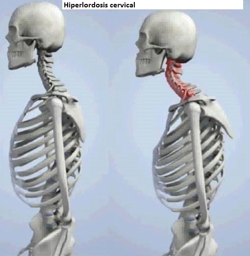 5. Pilates y las cervicales