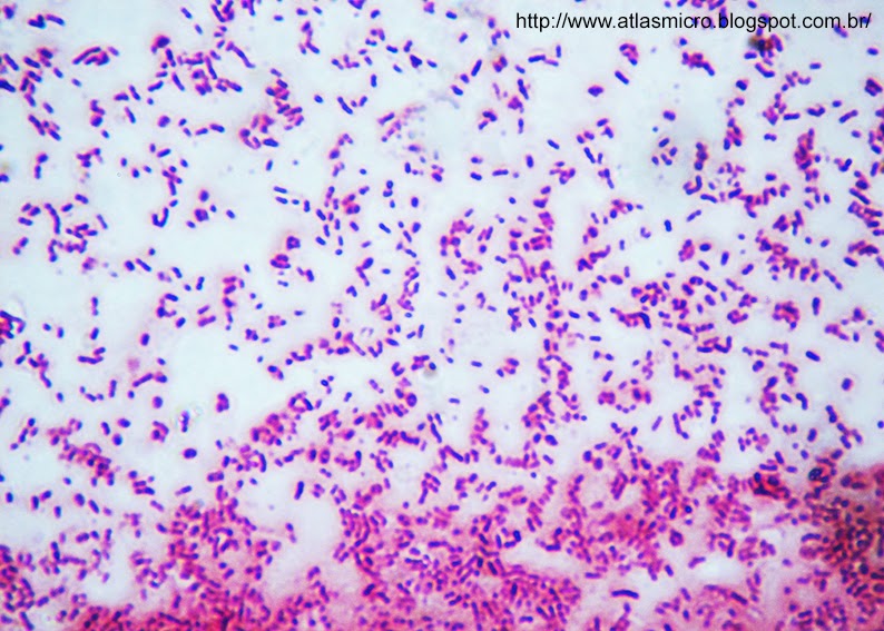 Atlas de Microbiologia: Bactérias