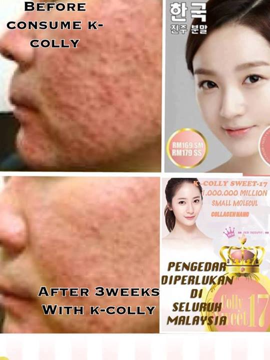 Pandorra's Beauty Shoppe : K-COLLY SWEET 17 COLLAGEN FROM KOREA ...