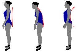 Alignment | Performance Sports Therapy