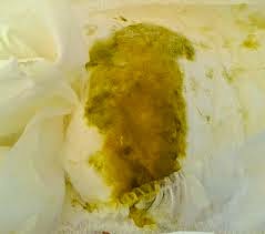 Con BeBe Tres: Otro pañal....ggggg.... ¡bieeeeen verdeeee!