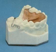 Dentistry and Medicine: Retention of removable Orthodontic appliences