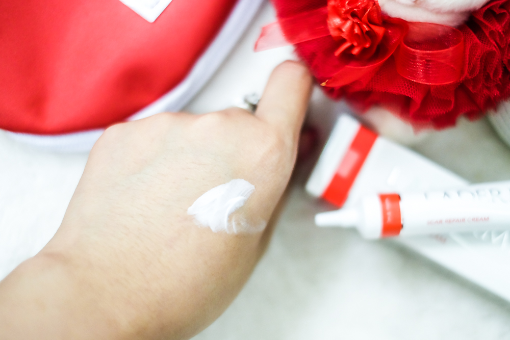 How to Heal Your Scar - Stella Lee ☆ Indonesia Beauty and Travel Blog