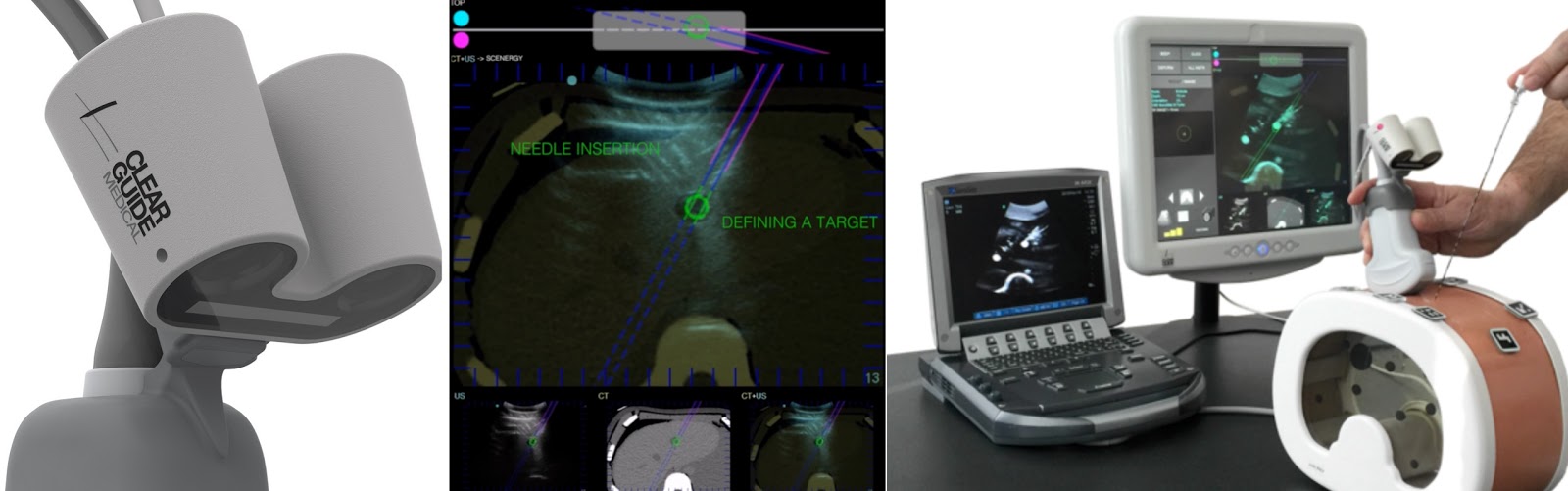 Clear Guide SCENERGY Ultrasound-CT Fusion System