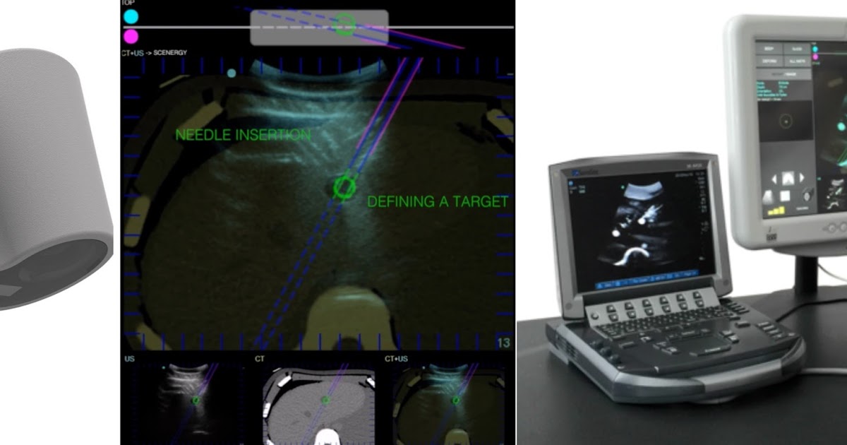 Clear Guide SCENERGY Ultrasound-CT Fusion System