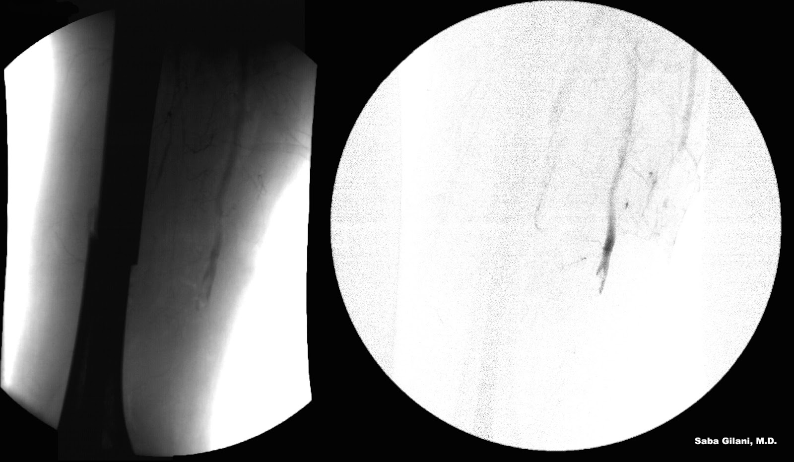 Roentgen Ray Reader: November 2012