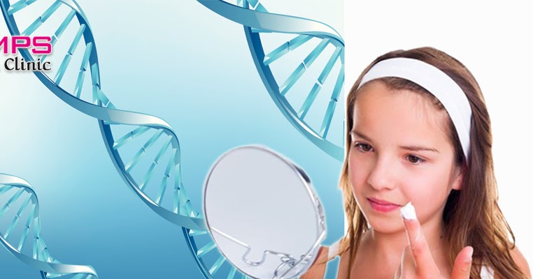 Know about Hormones and how does hormonal change affect your skin in ...