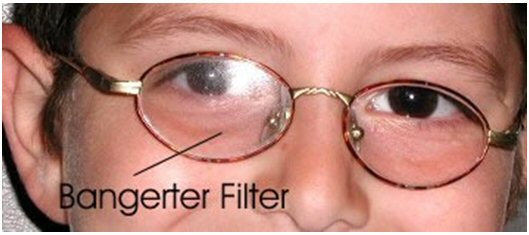 Cátedra N° 17 - Seminario N° 07 "Técnicas pleópticas"