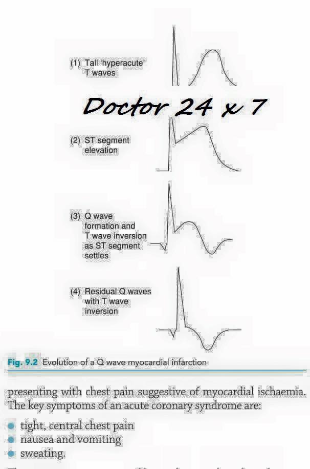 amudu: Easy way to learn ECG. Step by Step in a very easy way
