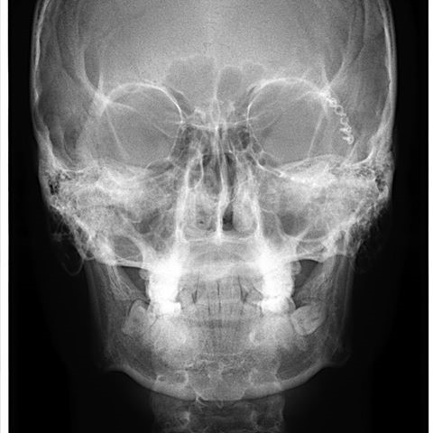 RADIOLOGÍA ESTOMATOLÓGICA “BUAP”: UNIDAD 9