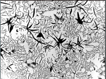 malayasteel: GRAPHITE STRUCTURES IN CAST IRONS : GRAPHITE DISTRIBUTION ...