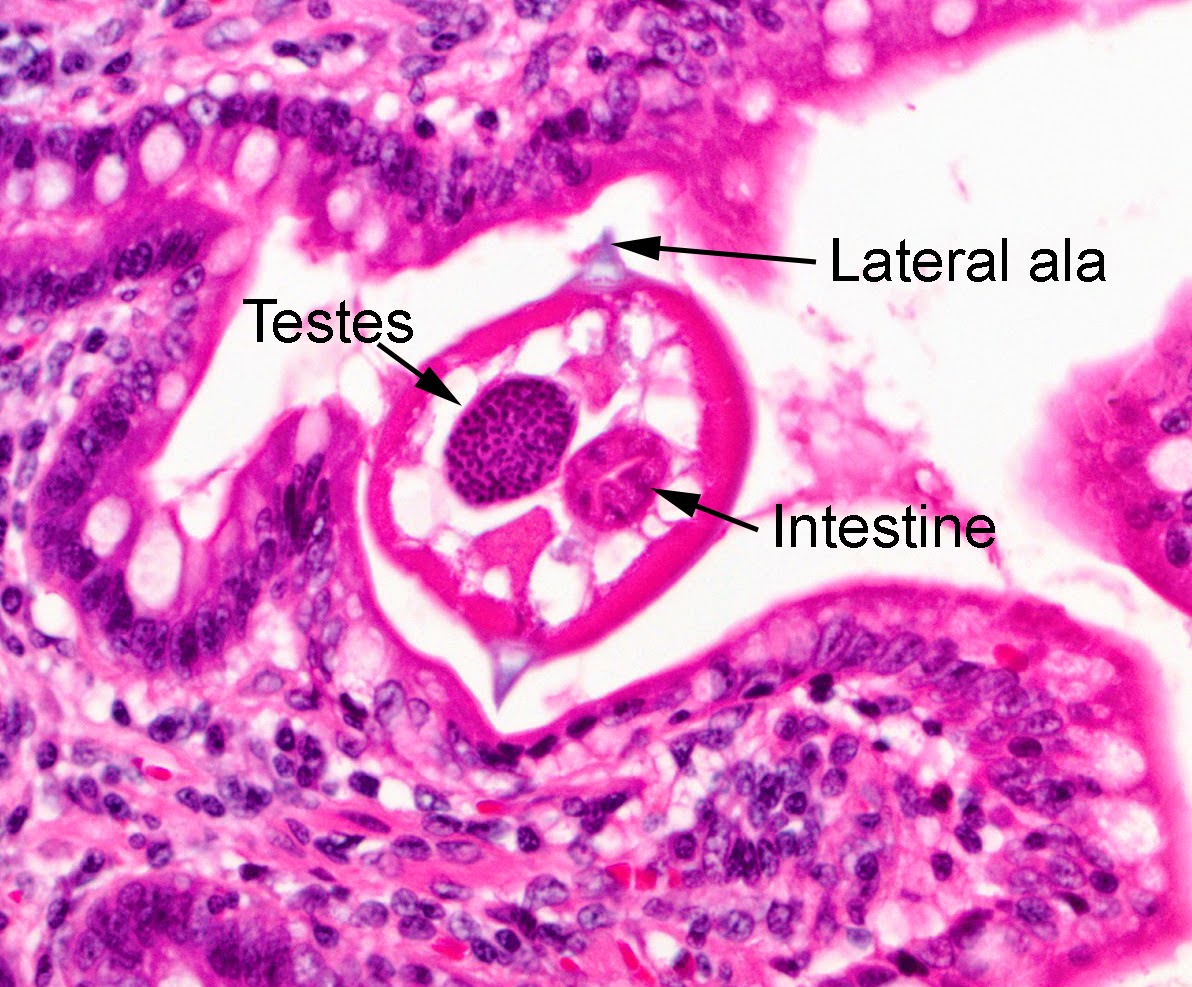 Creepy Dreadful Wonderful Parasites: Answer to Case 322