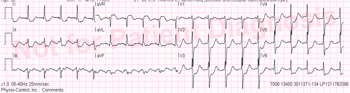 Dr. Smith's ECG Blog: December 2014