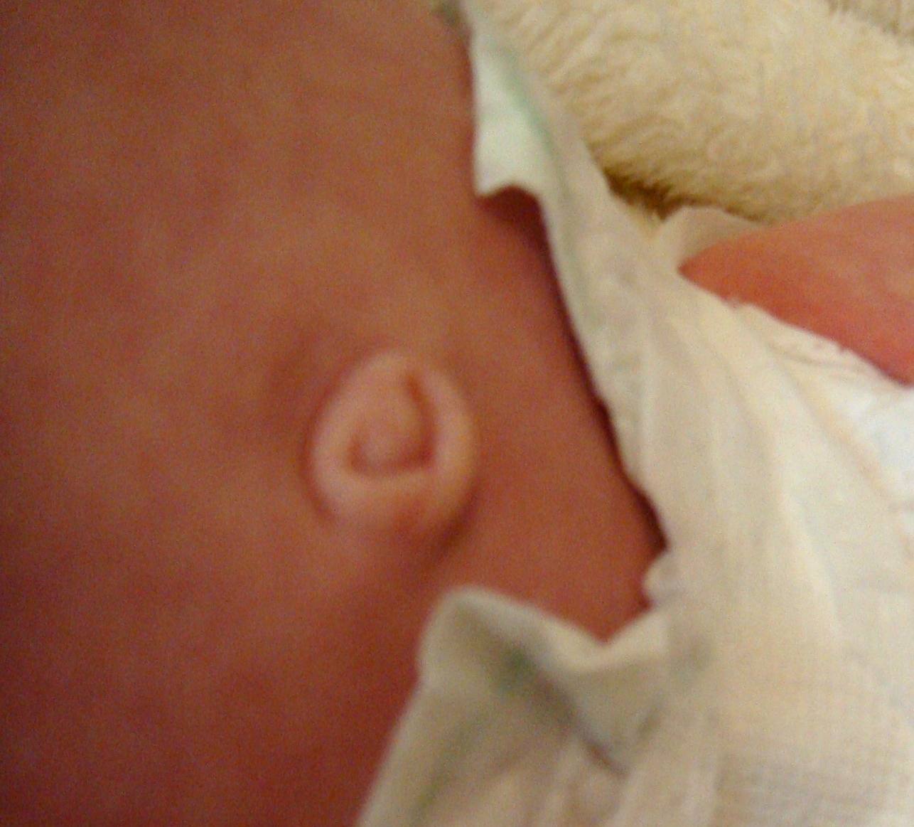 How To Wrap Baby Belly Button at Lorena Mullens blog