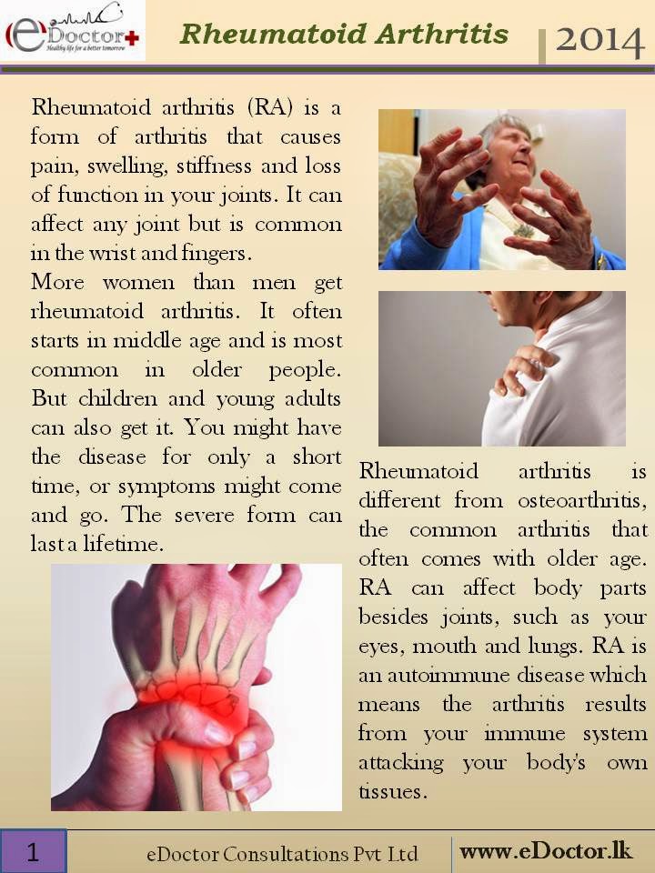 RHEUMATOID ARTHRITIS BY DR. KALEEL CASSIM MBBS, MD (MEDICINE) | eDoctor.lk