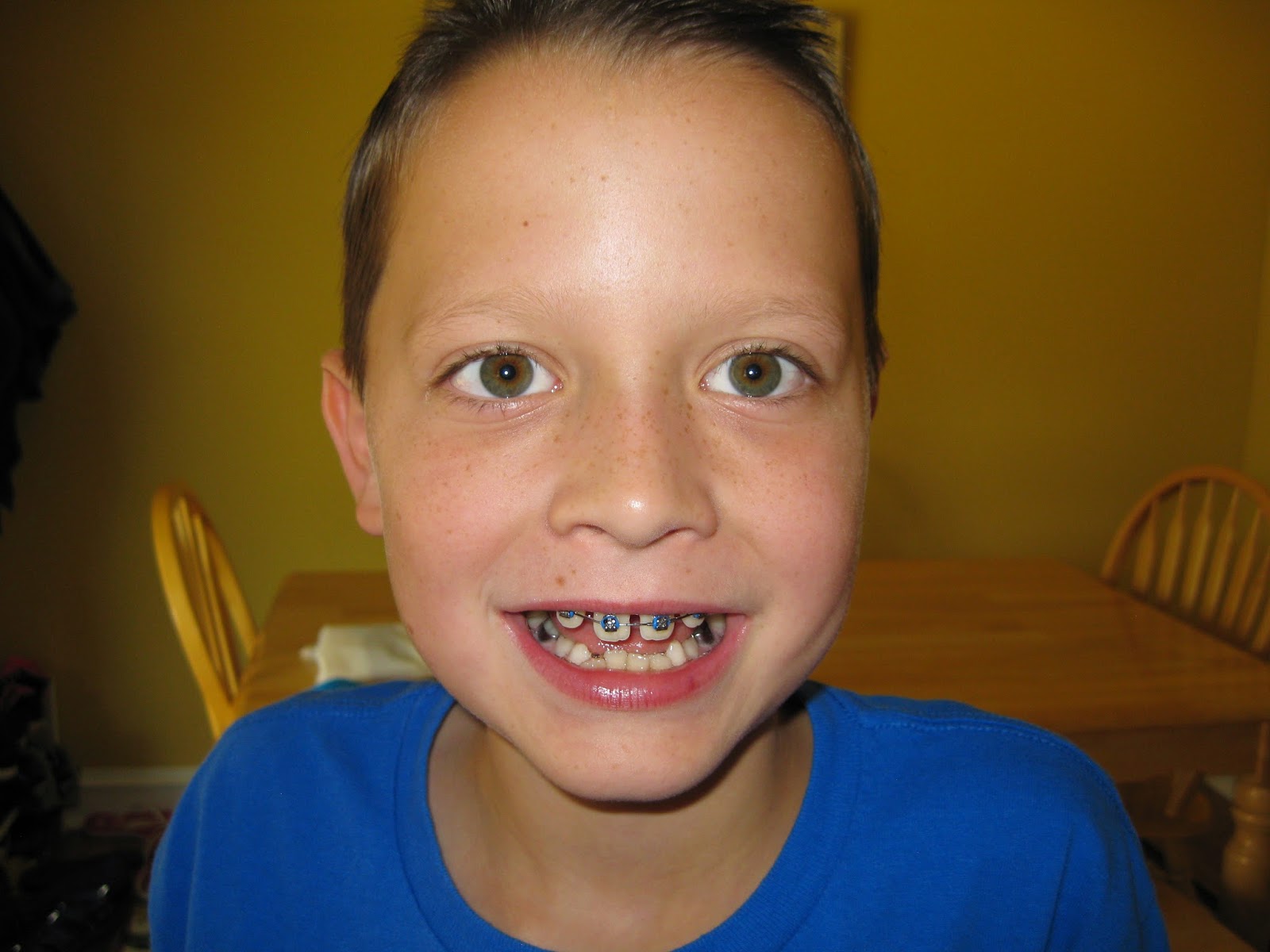 Lawlor Clan: Blake - last one to get braces