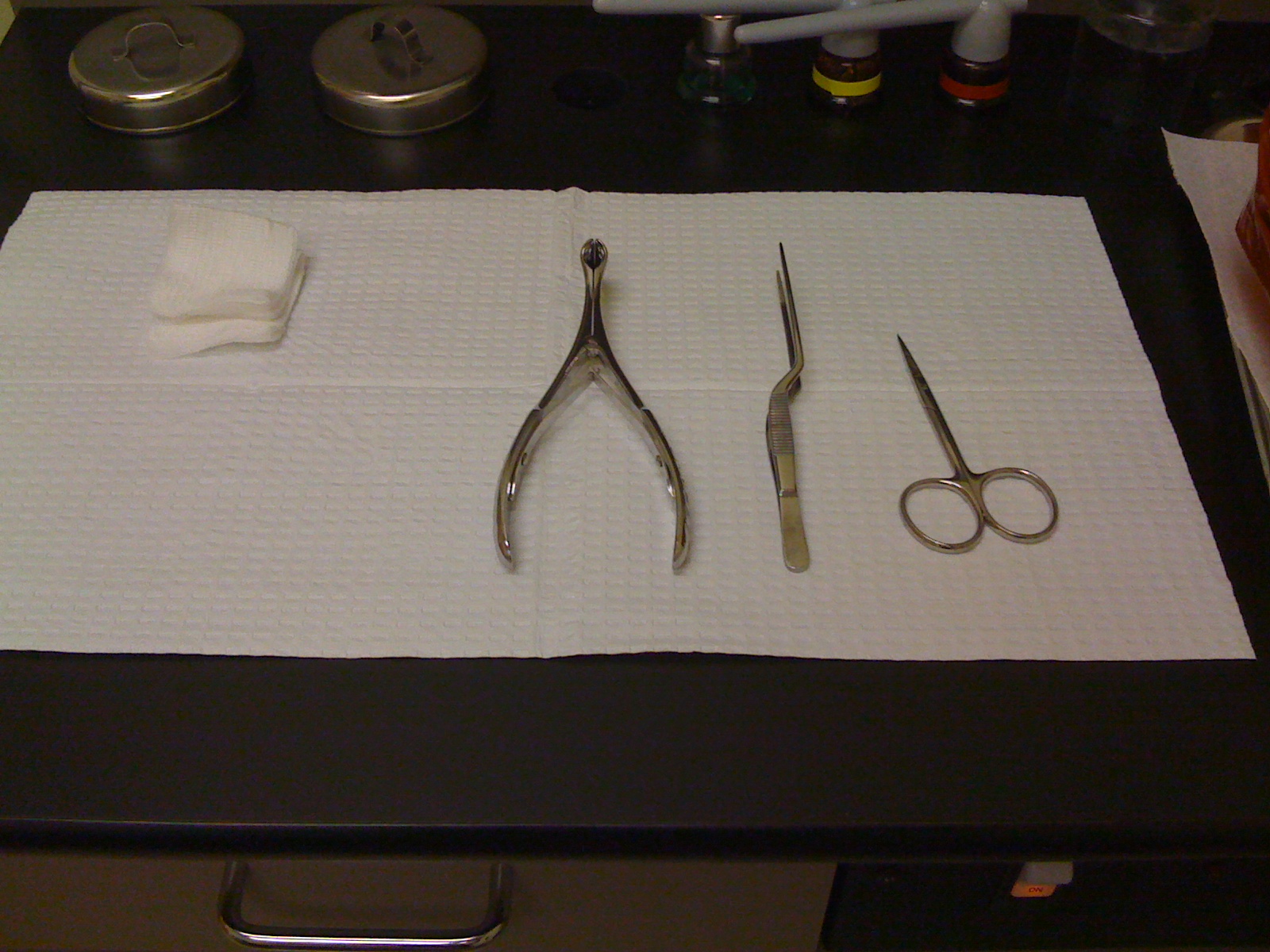 A Nose Adventure: Septoplasty: Day 7: Splints Out!