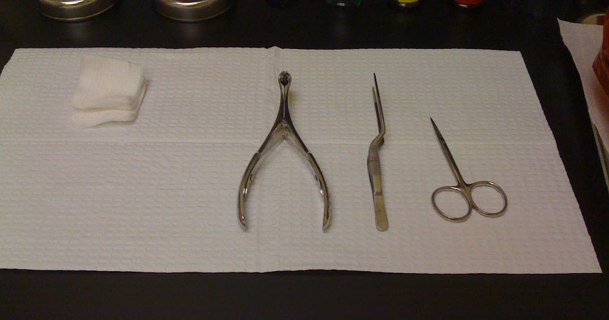 A Nose Adventure: Septoplasty: Day 7: Splints Out!